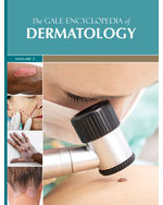 The Gale Encyclopedia of Dermatology